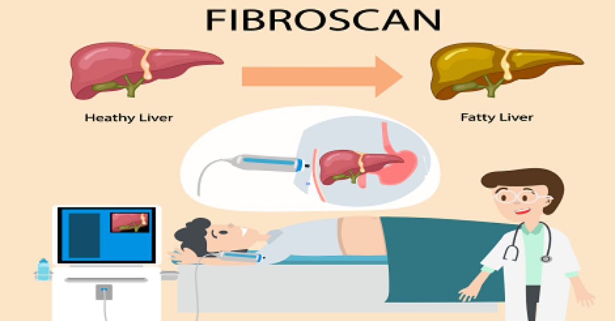 Best Fibroscan Hospital In Rewari | Fibroscan Treatment