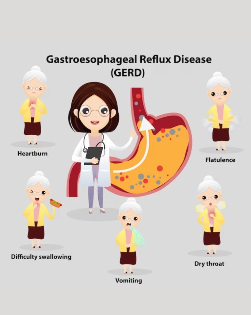 GASTROESOPHAGEAL REFLUX - Dr. Neel Kamal