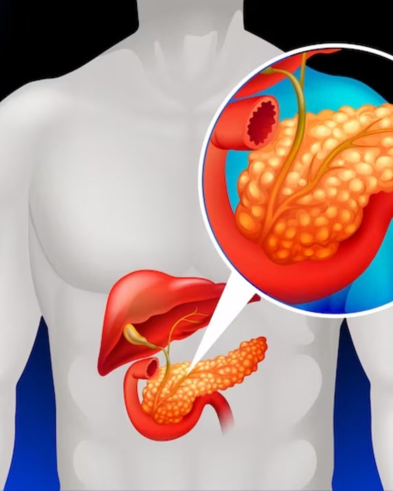 Best Pancreatic Treatment In Rewari | Dr Neel Kamal Hospital