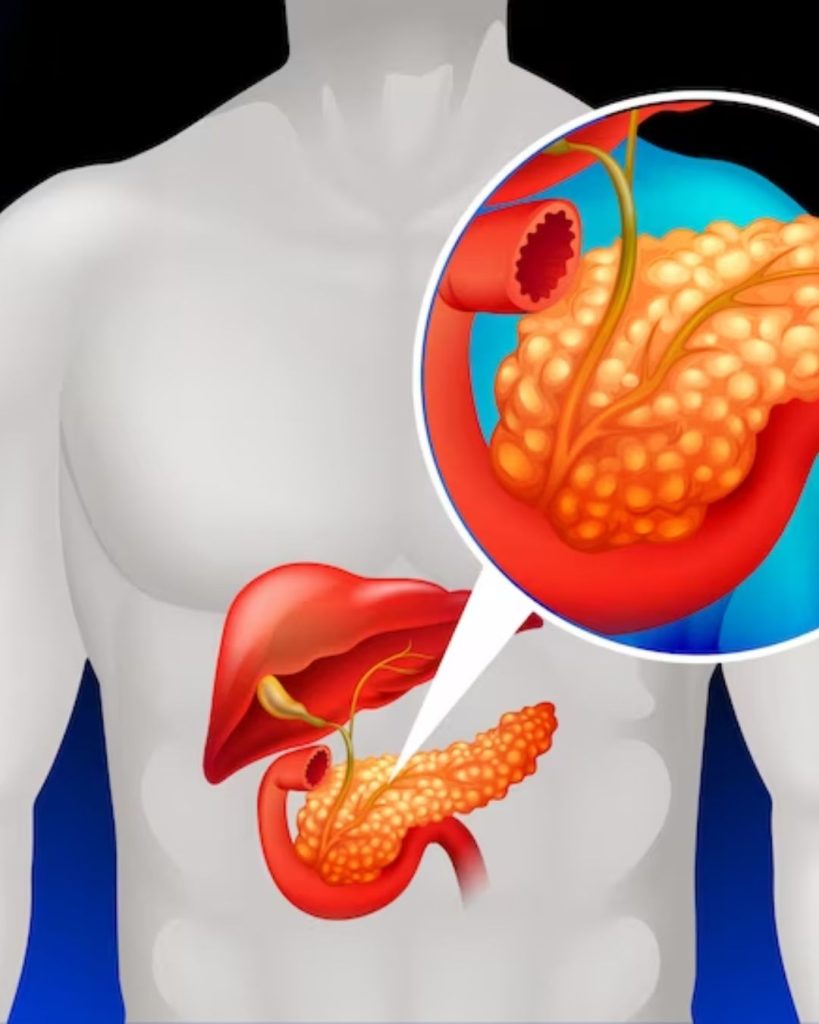 Best Pancreatic Treatment In Rewari | Dr Neel Kamal Hospital